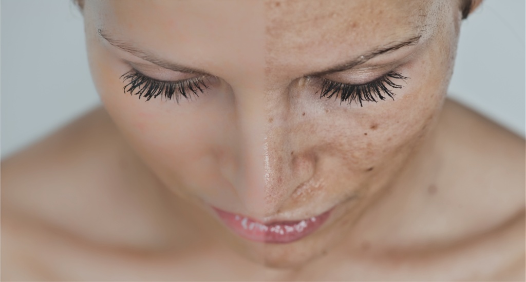 Clinique Esthétique Bordeaux – Médecine Esthétique | CLEO