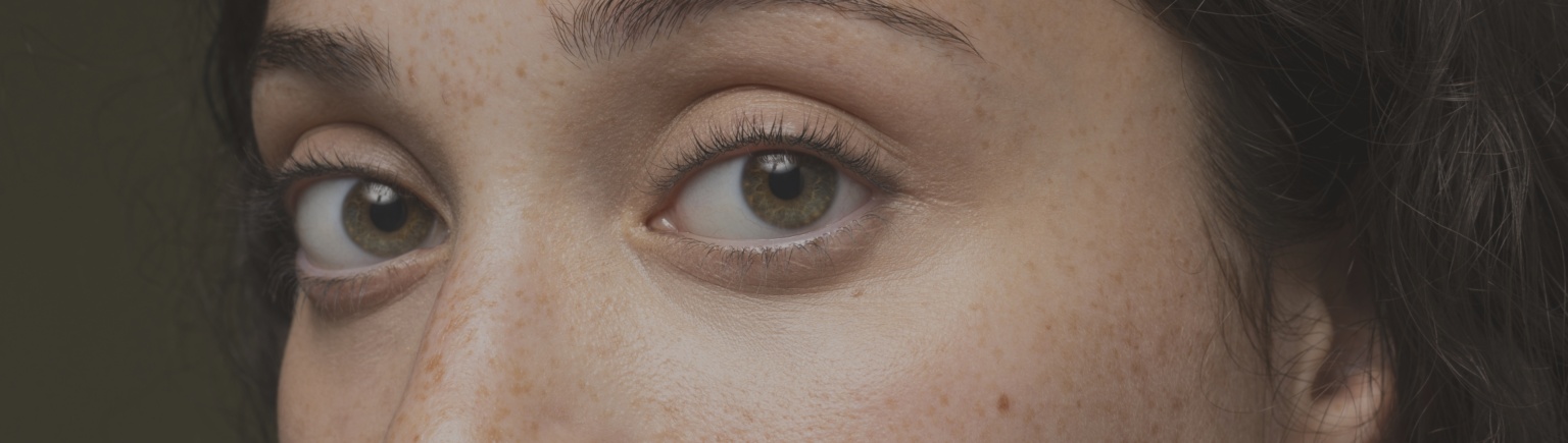 Laser pigmentaire - Cleo Bordeaux