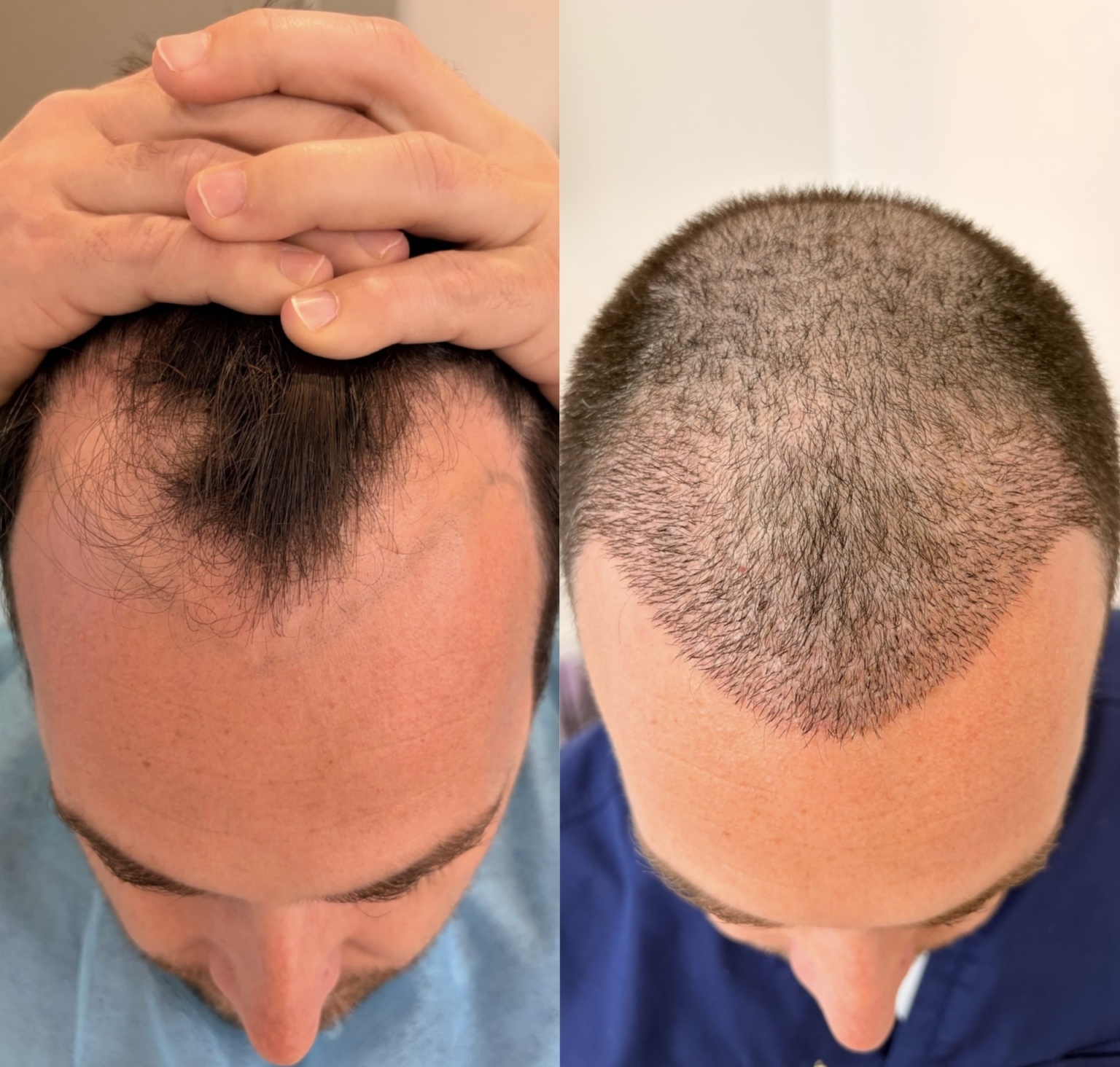 Clinique Esthétique Bordeaux – Médecine Esthétique | CLEO